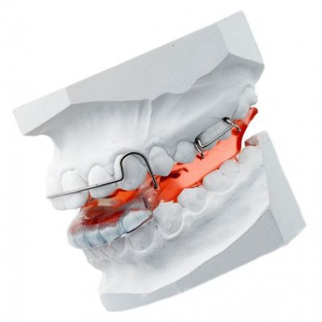 Blokbeugel - Kliniek de Meern